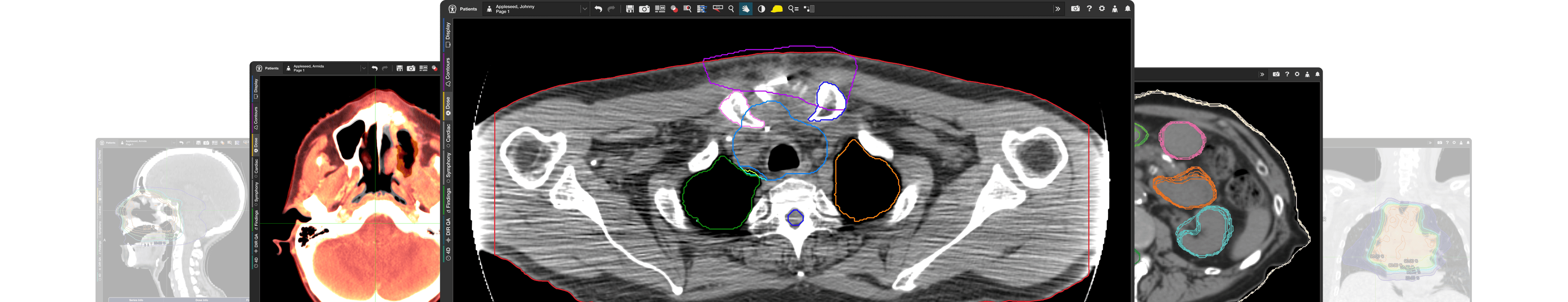 MIM Software Inc. | Precision Care Simplified