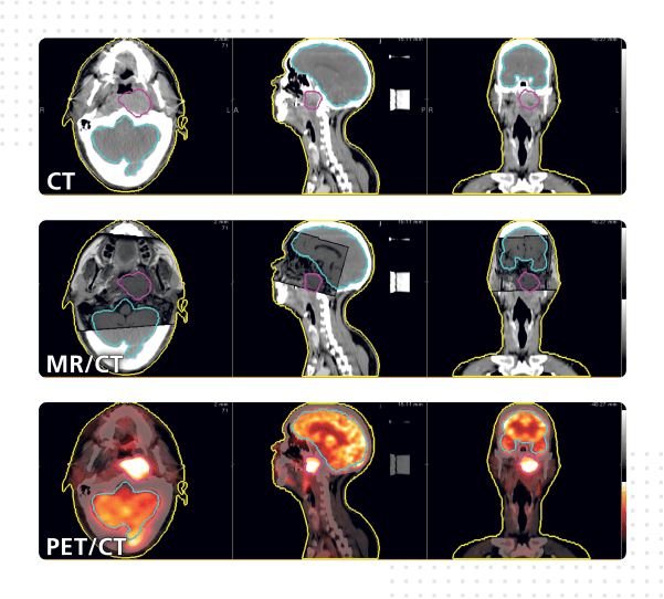MIM Maestro® Image Registration | MIM Software