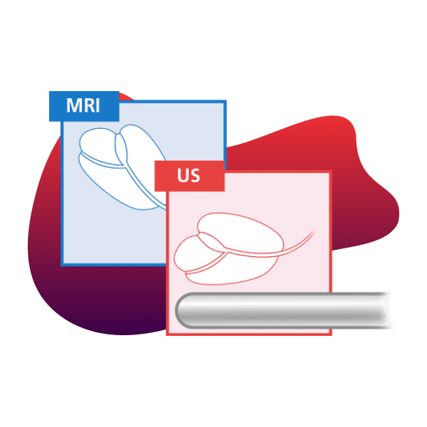 MIM Symphony HDR Fusion | MIM Software