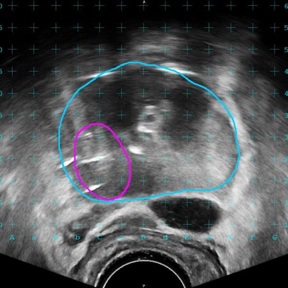 MIM Symphony HDR Fusion | MIM Software