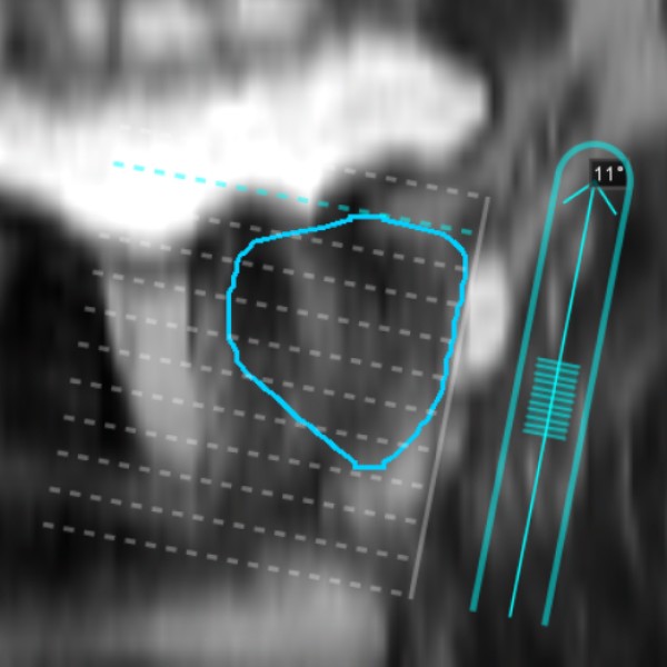 MIM Symphony HDR Fusion | MIM Software