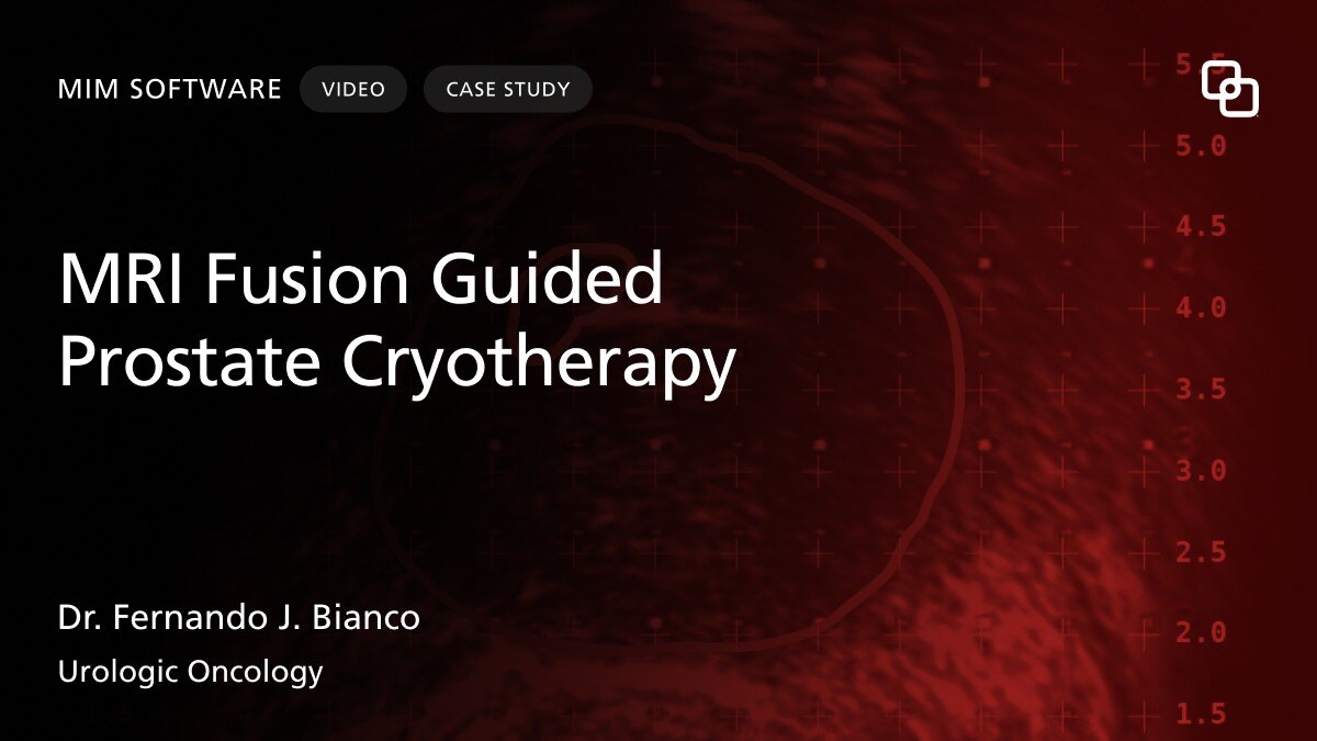 Case Studies | MRI Fusion Guided Prostate Cryotherapy